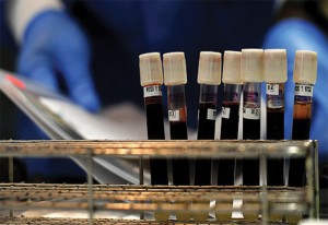 Controversial USPSTF Decision on PSA Screening Worries Patients and ...